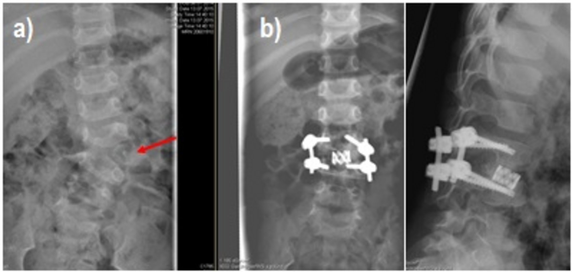 Leistungsspektrum - Wirbelsäulenchirurgie: Klinikum Dortmund - Größtes ...