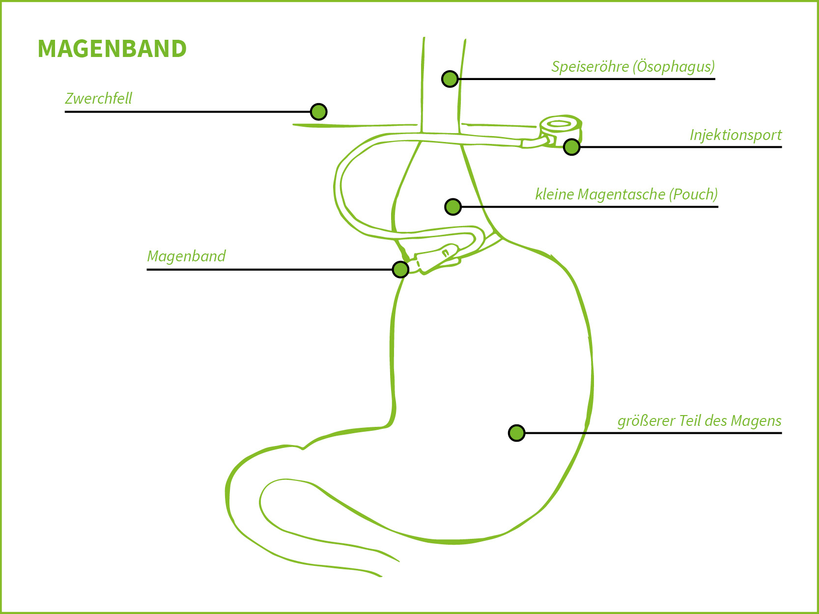 Operative Verfahren - Adipositas-Zentrum: Klinikum Dortmund - Größtes ...